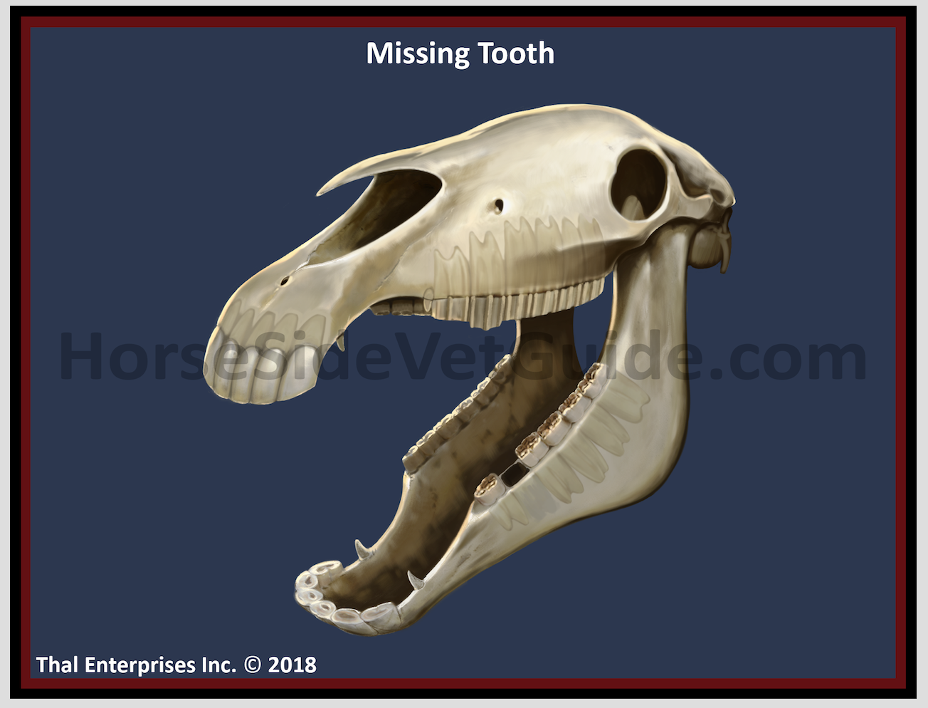 Teeth Missing Cheek Tooth Resulting In High Opposing Tooth | Horse Side ...