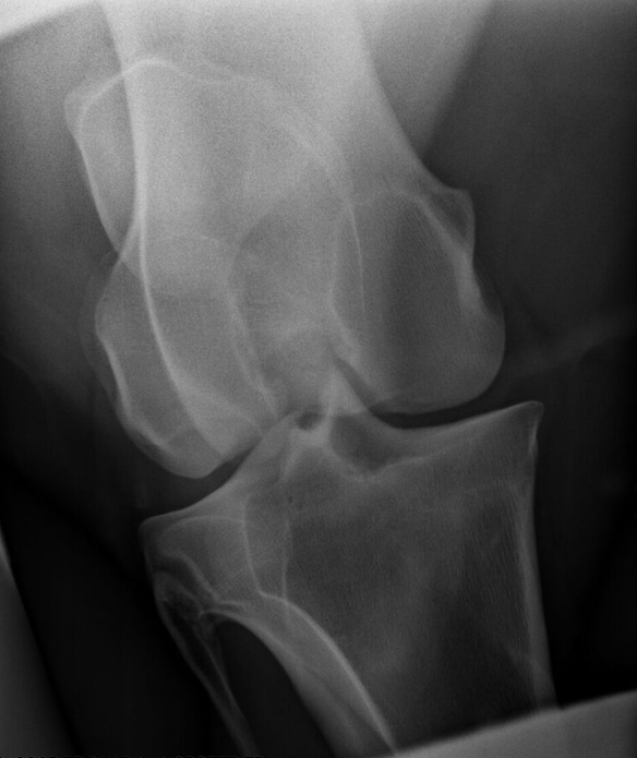 Radiograph Stifle Normal Cranio Caudal View Front To Back | Horse Side ...