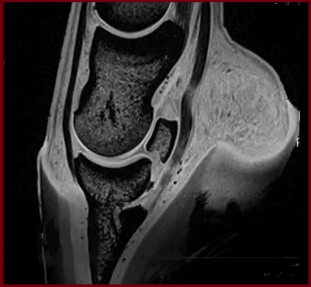 Understanding Navicular Syndrome & Heel Pain in Horses | Horse Side Vet ...